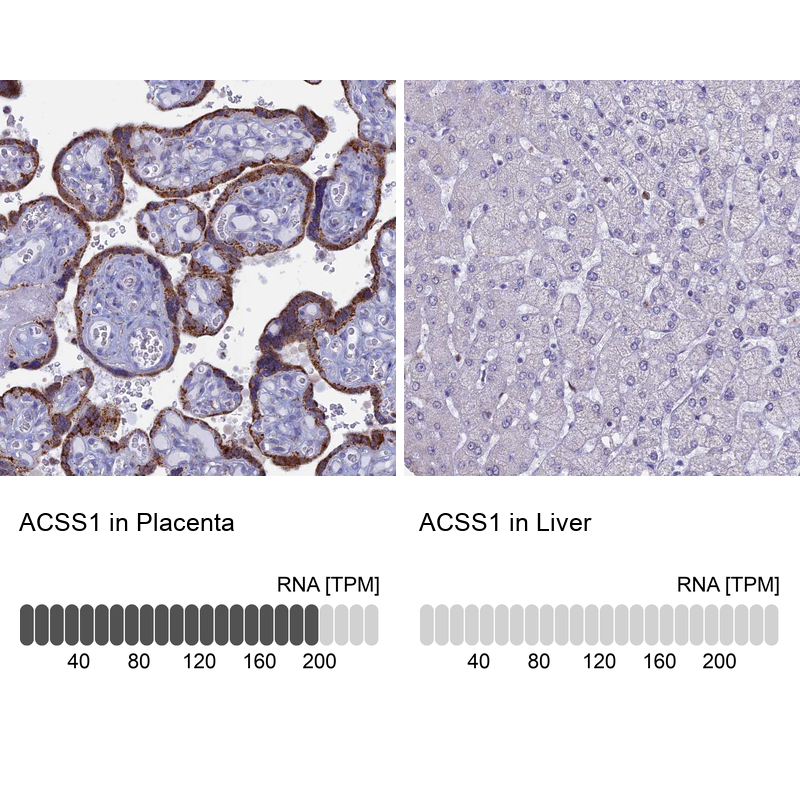 Rabbit Polyclonal Anti-ACSS1 Antibody - Buy for research - Highly ...