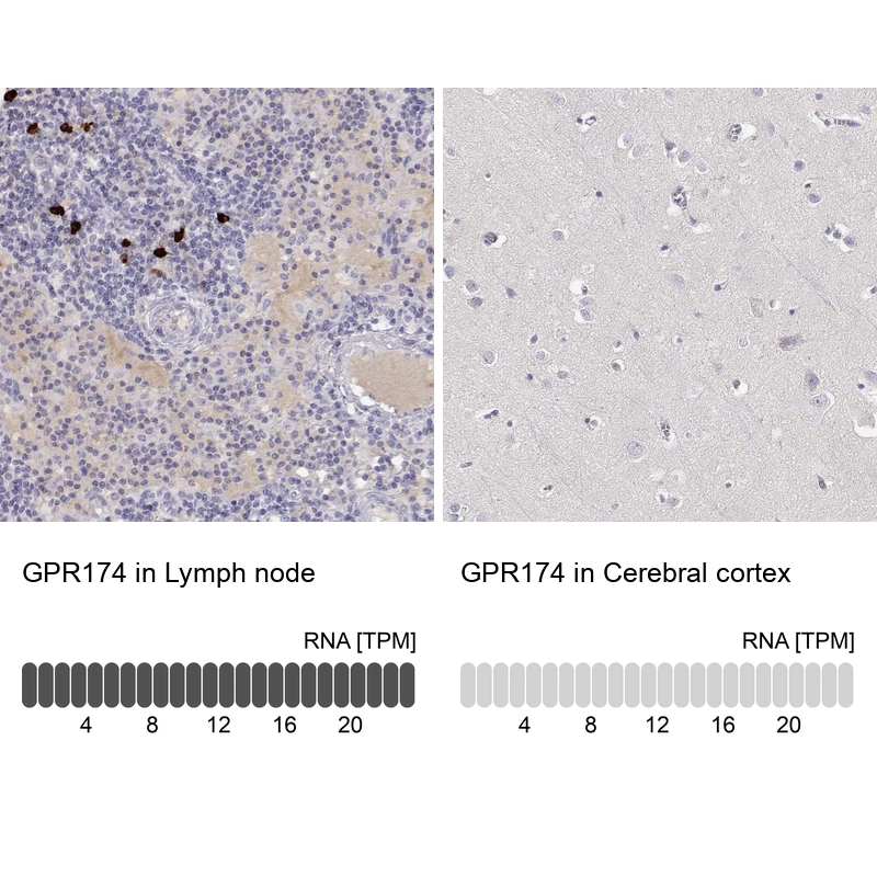 Rabbit Polyclonal Anti-GPR174 Antibody - Buy for research - Highly ...