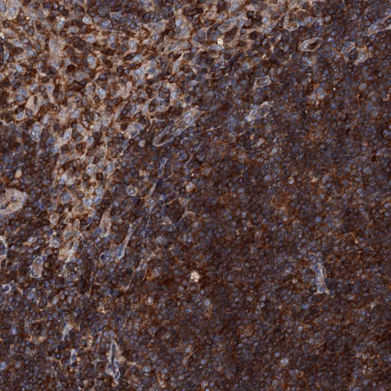 Rabbit Polyclonal Anti-EDC4 Antibody - Buy for research - Highly ...