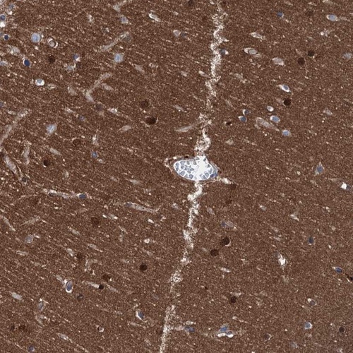 Rabbit Polyclonal Anti-CBLN3 Antibody - Buy for research - Highly ...