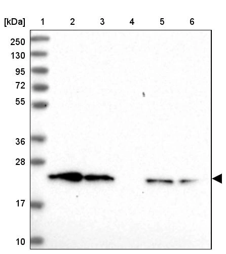Rabbit Polyclonal Anti-ATP5O Antibody - Buy for research - Highly ...