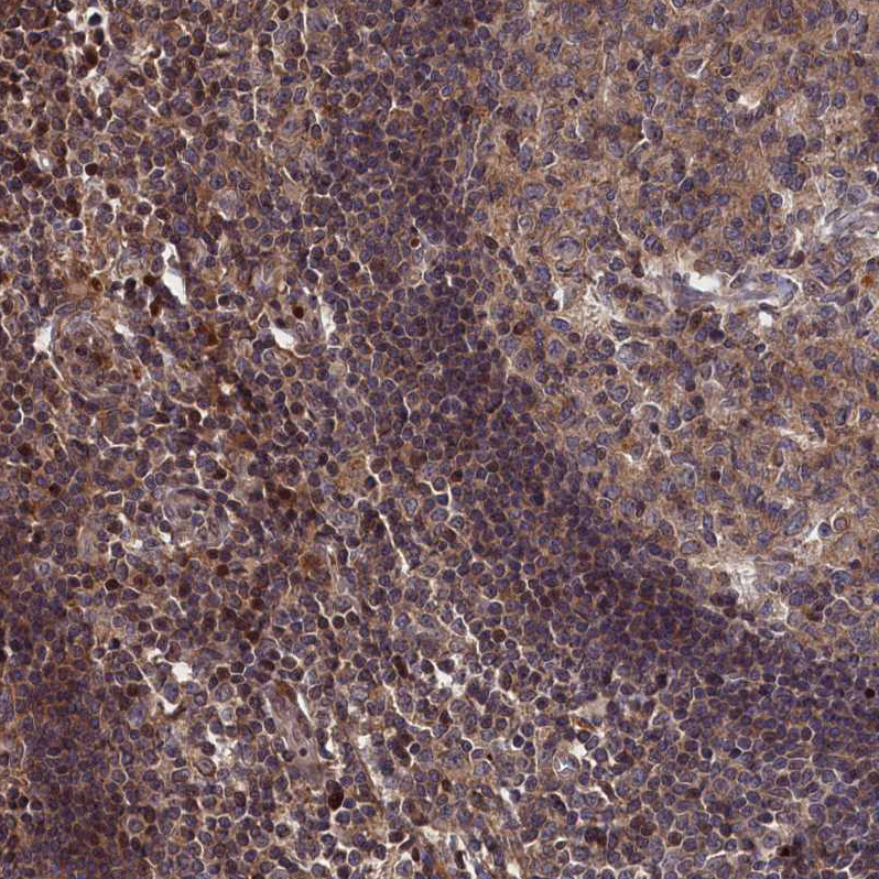 Rabbit Polyclonal Anti-PLA2G15 Antibody - Buy for research - Highly ...