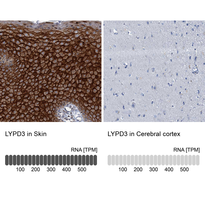 Rabbit Polyclonal Anti-LYPD3 Antibody - Buy for research - Highly ...