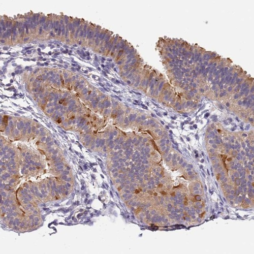 Rabbit Polyclonal Anti-CFAP161 Antibody - Buy for research - Highly ...