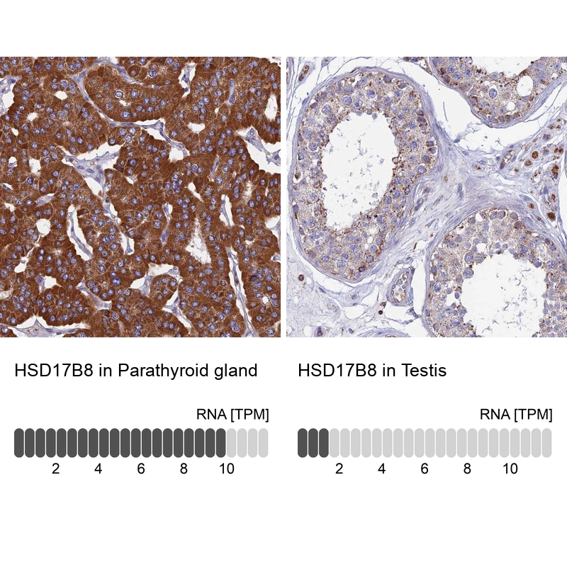 Rabbit Polyclonal Anti-HSD17B8 Antibody - Buy for research - Highly ...
