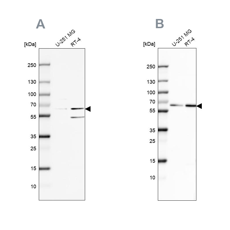 Rabbit Polyclonal Anti-SF3A2 Antibody - Buy for research - Highly ...