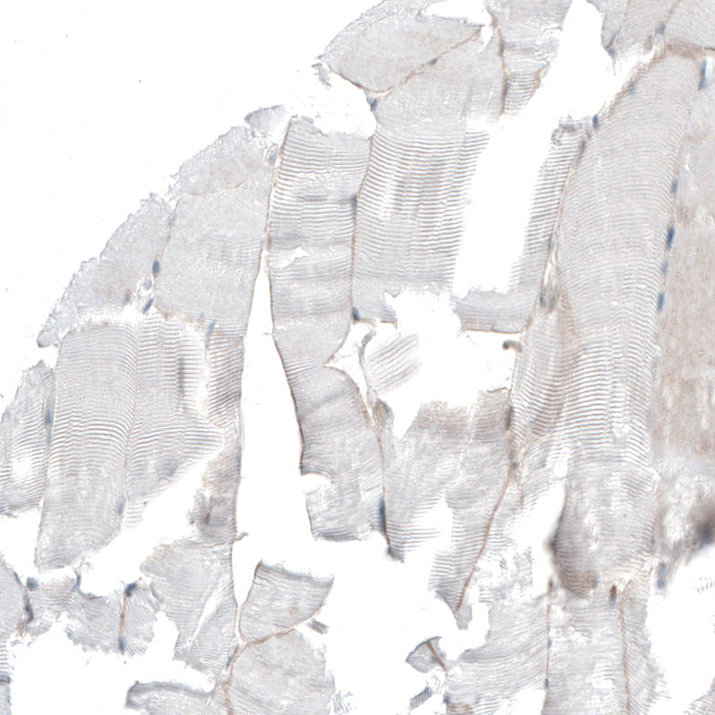 Rabbit Polyclonal Anti-PAPD5 Antibody - Buy for research - Highly ...