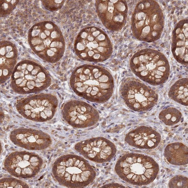 Rabbit Polyclonal Anti-GLE1 Antibody - Buy for research - Highly ...
