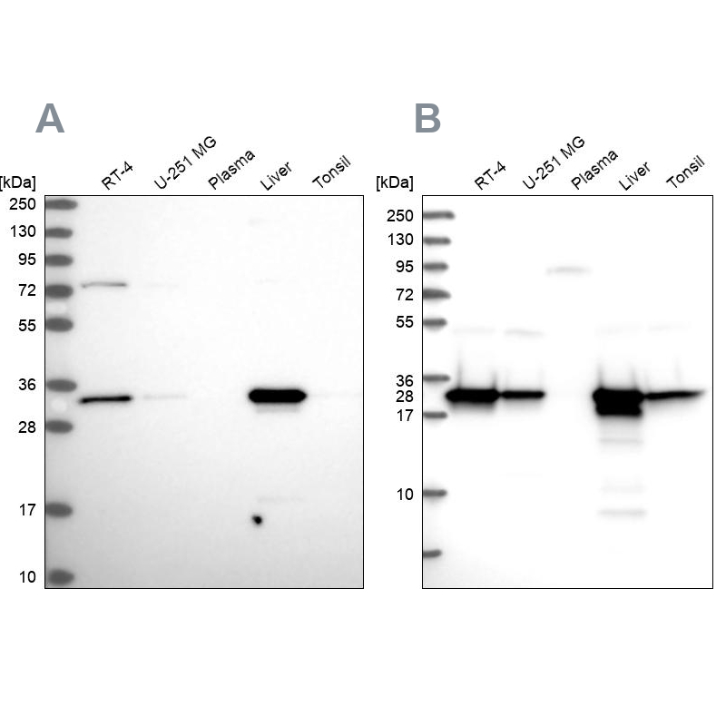 Rabbit Polyclonal Anti-HADH Antibody - Buy for research - Highly ...