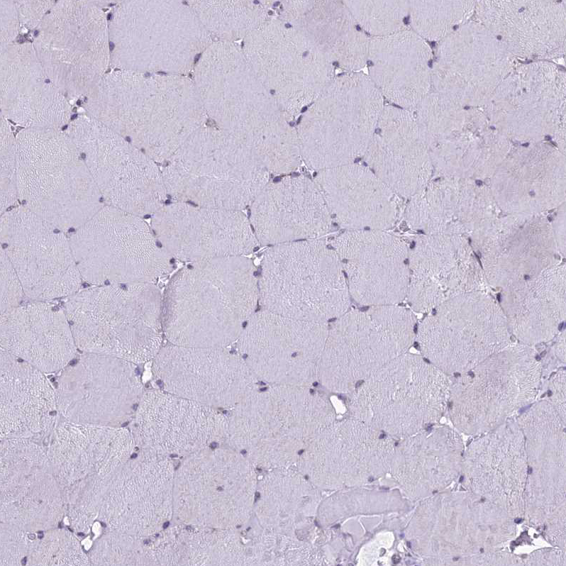 Rabbit Polyclonal Anti-RPS26 Antibody - Buy for research - Highly ...