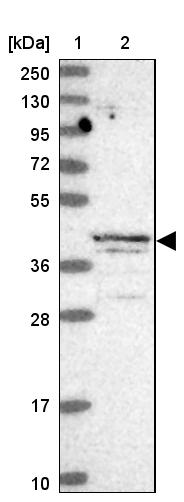 Rabbit Polyclonal Anti-ALKBH1 Antibody - Buy for research - Highly ...