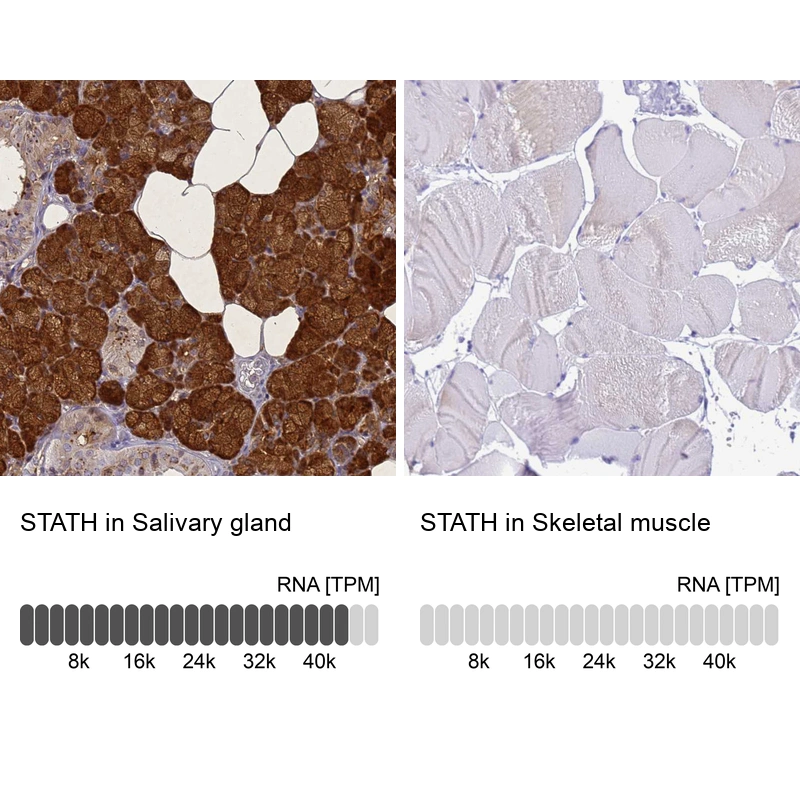Rabbit Polyclonal Anti-STATH Antibody - Buy for research - Highly ...