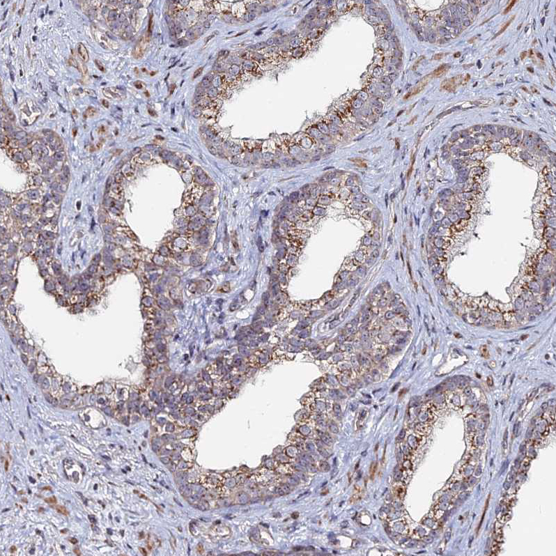 Rabbit Polyclonal Anti-SGMS1 Antibody - Buy for research - Highly ...