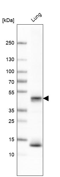 Rabbit Polyclonal Anti-SGMS1 Antibody - Buy for research - Highly ...