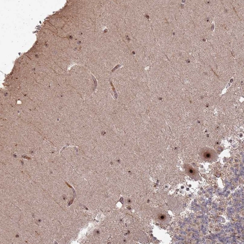 Rabbit Polyclonal Anti-UTP11 Antibody - Buy for research - Highly ...