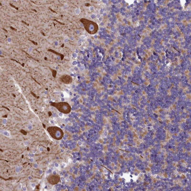 Rabbit Polyclonal Anti-SMPD4 Antibody - Buy for research - Highly ...