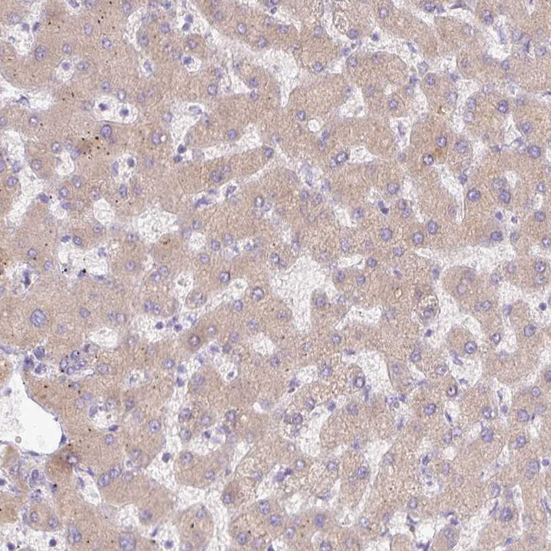 Rabbit Polyclonal Anti-C4A Antibody - Buy for research - Highly ...