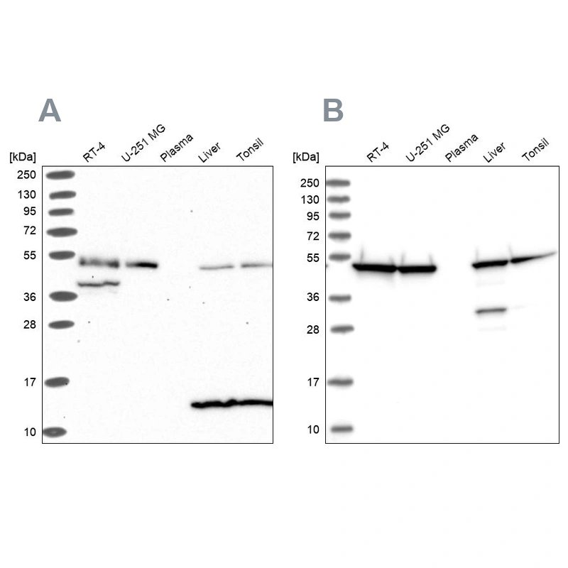 Rabbit Polyclonal Anti-ST13 Antibody - Buy for research - Highly ...
