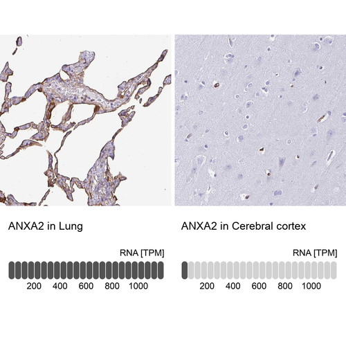 Anti-ANXA2 Human Protein Atlas Antibody