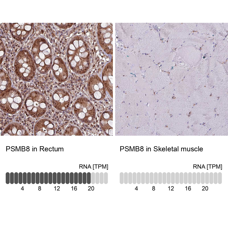 Rabbit Polyclonal Anti-PSMB8 Antibody - Buy for research - Highly ...