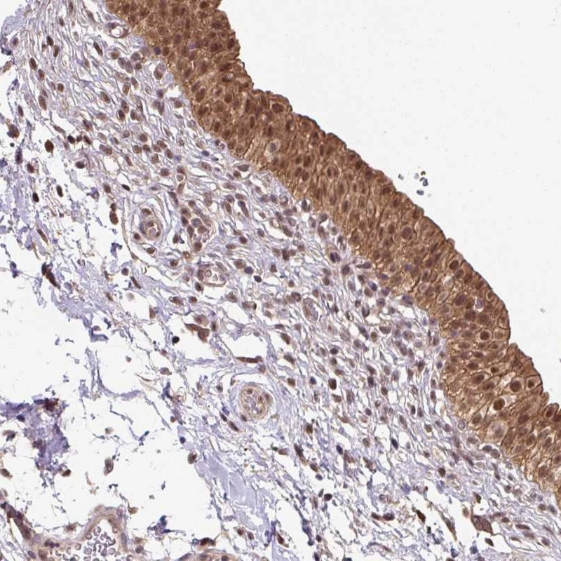 Rabbit Polyclonal Anti-ST13 Antibody - Buy for research - Highly ...