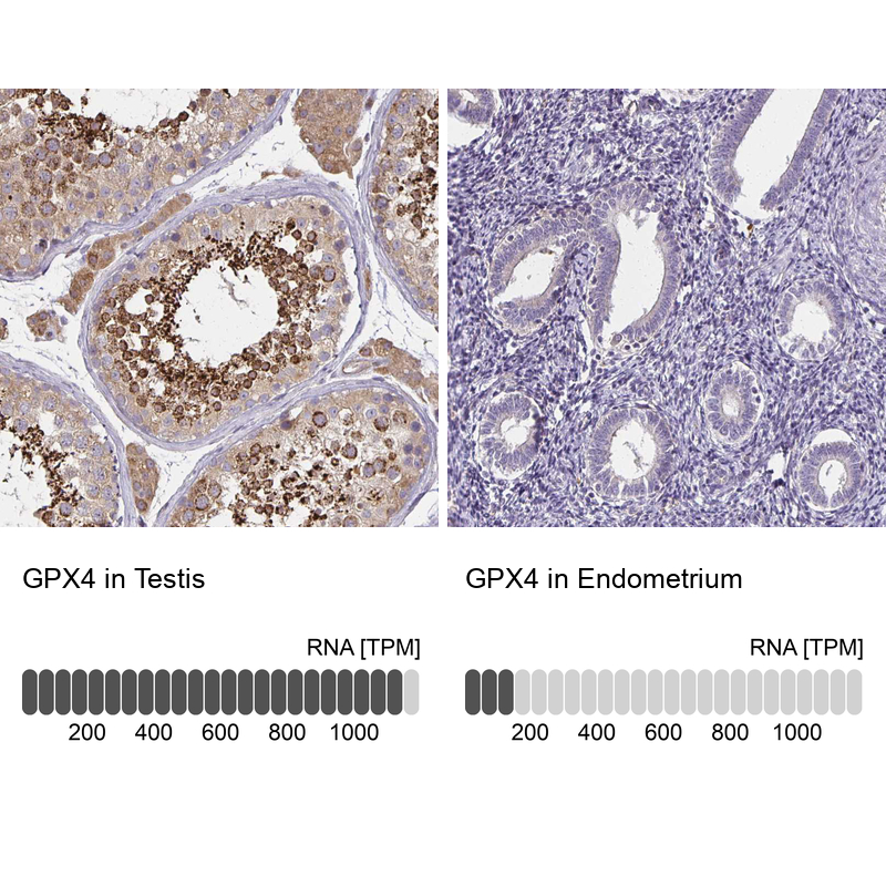 Rabbit Polyclonal Anti-GPX4 Antibody - Buy for research - Highly specific, rigorously validated ...