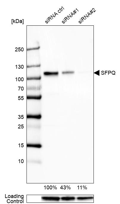 Rabbit Polyclonal Anti-SFPQ Antibody - Buy for research - Highly ...