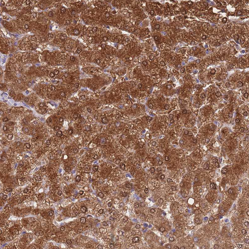 Rabbit Polyclonal Anti-ADH1A Antibody - Buy for research - Highly ...