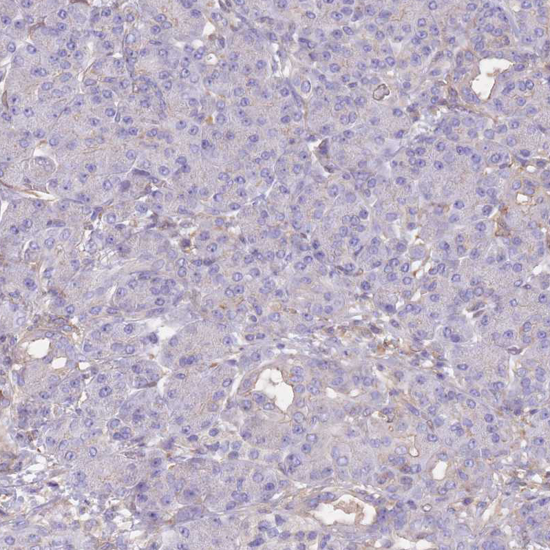 Rabbit Polyclonal Anti-ADH1A Antibody - Buy for research - Highly ...