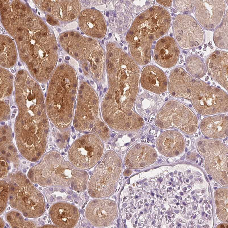 Rabbit Polyclonal Anti-TKFC Antibody - Buy for research - Highly ...