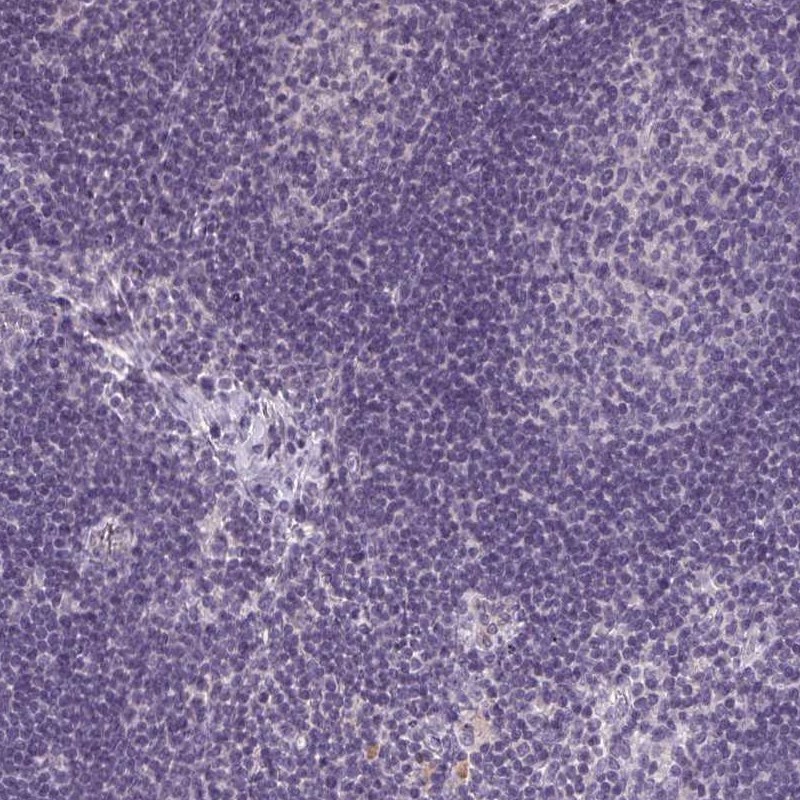 Rabbit Polyclonal Anti-TMEM27 Antibody - Buy for research - Highly ...