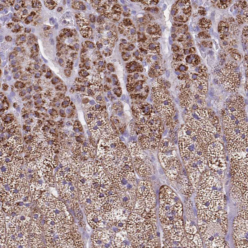 Rabbit Polyclonal Anti-CYP11B2 Antibody - Buy for research - Highly ...