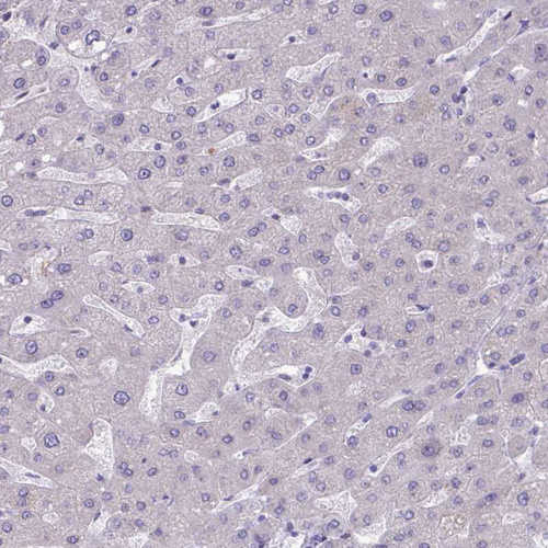 Rabbit Polyclonal Anti-DSC3 Antibody - Buy for research - Highly ...