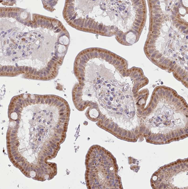 Rabbit Polyclonal Anti-SEC61B Antibody - Buy for research - Highly ...