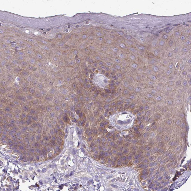 Rabbit Polyclonal Anti-GAN Antibody - Buy for research - Highly ...