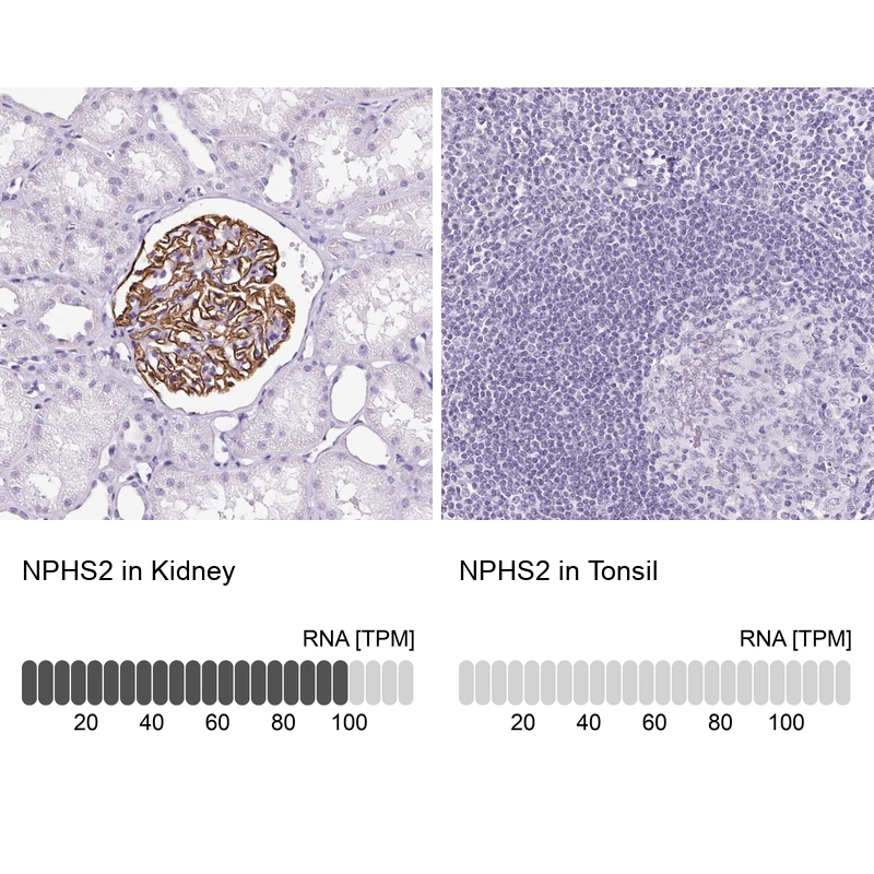 Rabbit Polyclonal Anti-NPHS2 Antibody - Buy for research - Highly ...