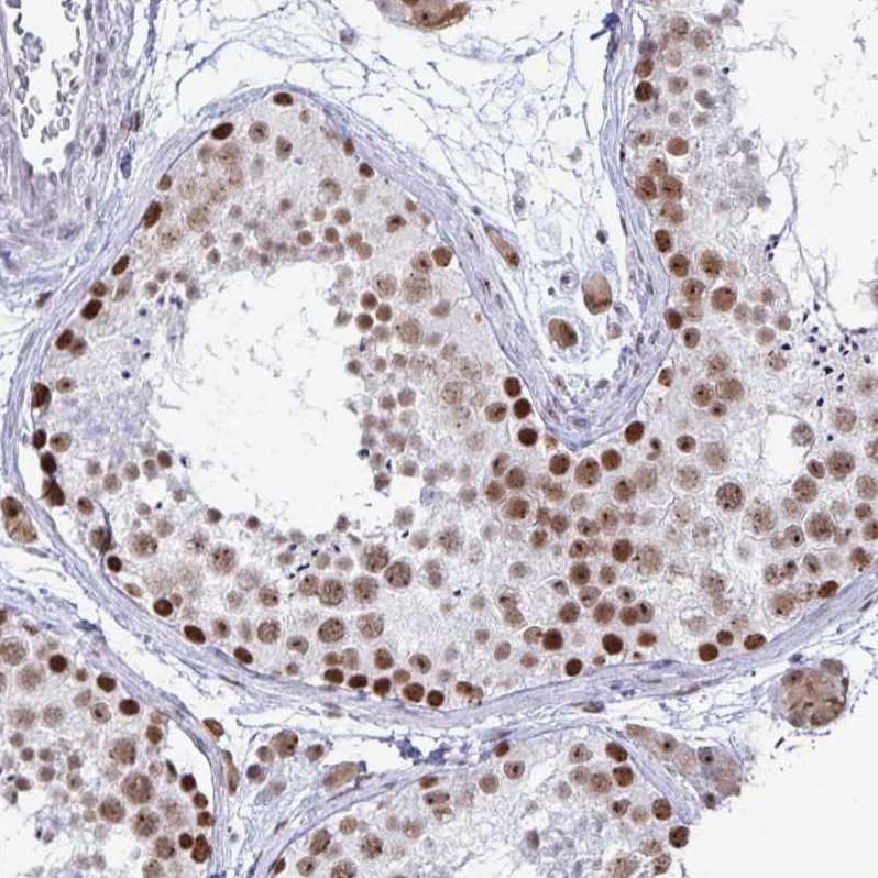 Rabbit Polyclonal Anti-SUPT16H Antibody - Buy for research - Highly ...