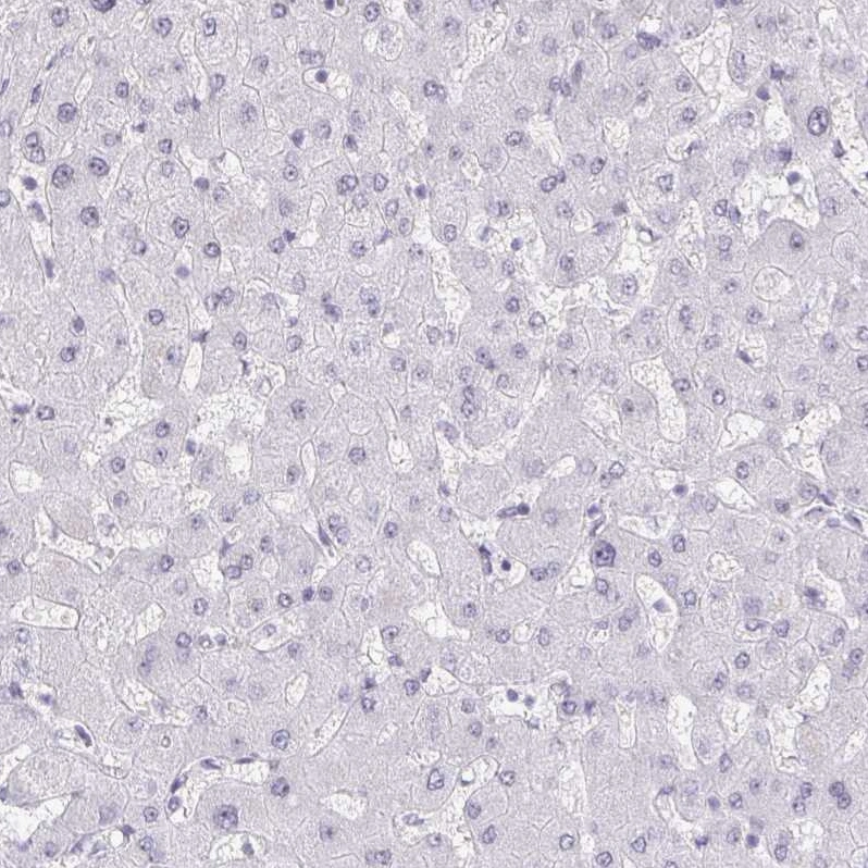 Rabbit Polyclonal Anti-SUPT16H Antibody - Buy for research - Highly ...