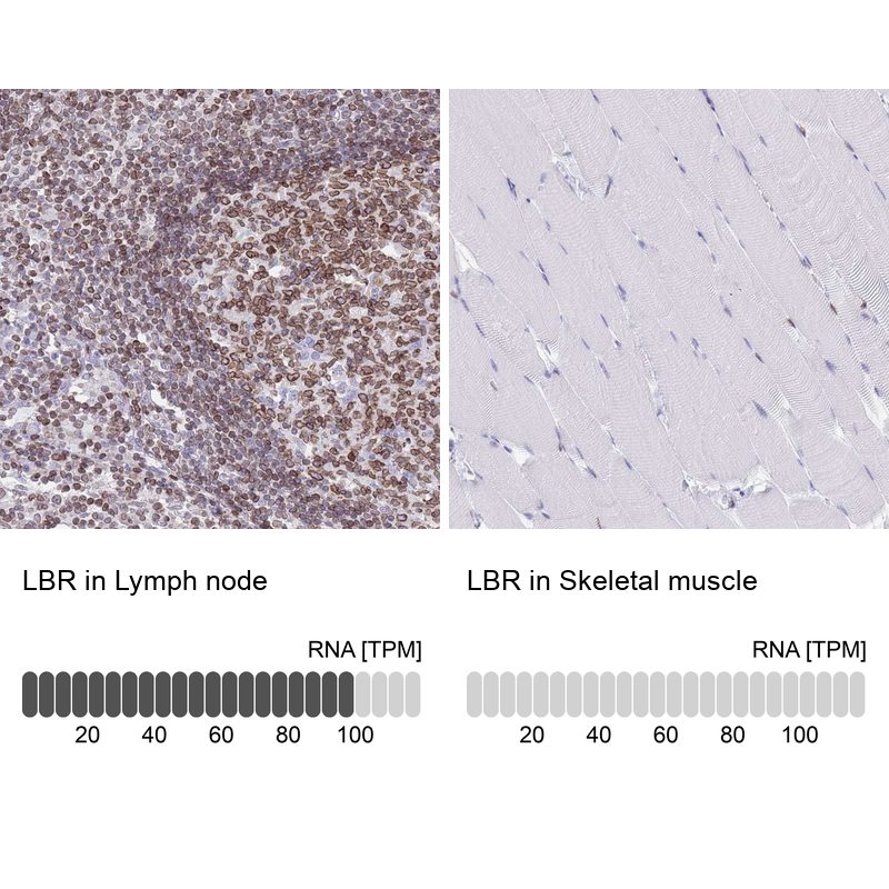 Rabbit Polyclonal Anti-LBR Antibody - Buy for research - Highly ...