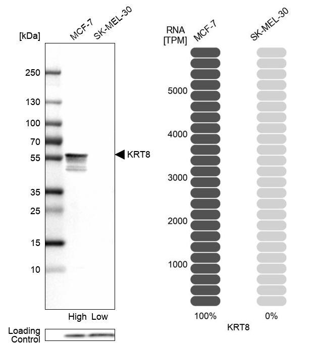 Rabbit Polyclonal Anti-KRT8 Antibody - Buy for research - Highly ...