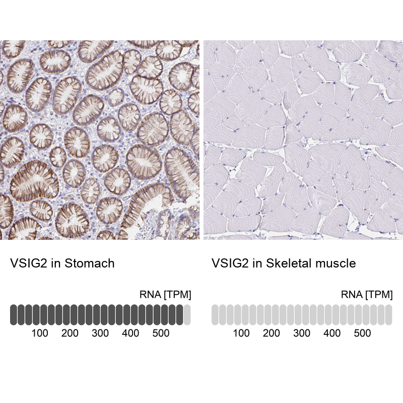Rabbit Polyclonal Anti-VSIG2 Antibody - Buy for research - Highly ...