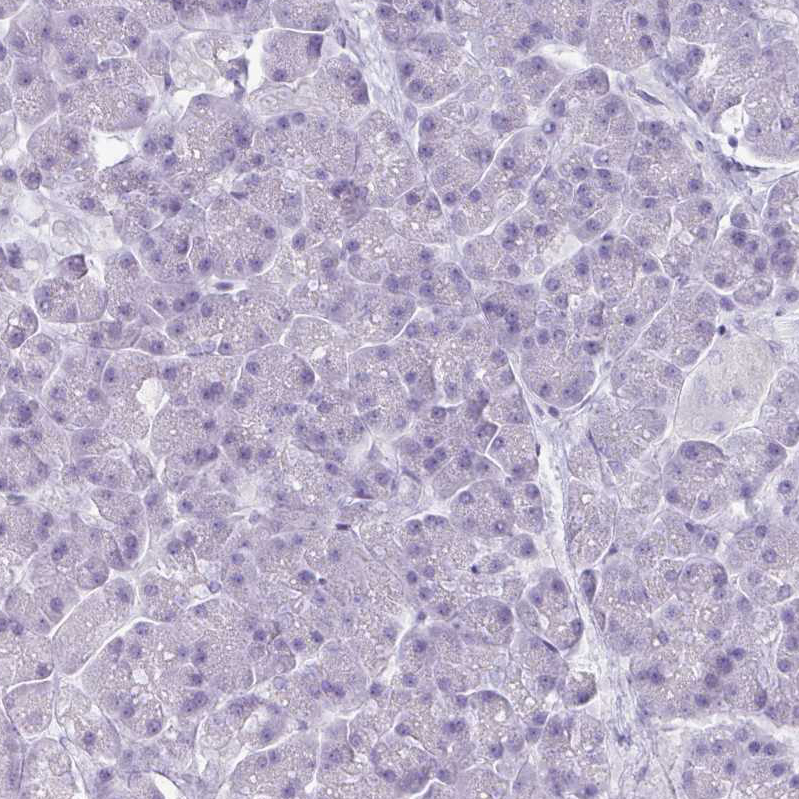 Rabbit Polyclonal Anti-SLC17A7 Antibody - Buy for research - Highly ...