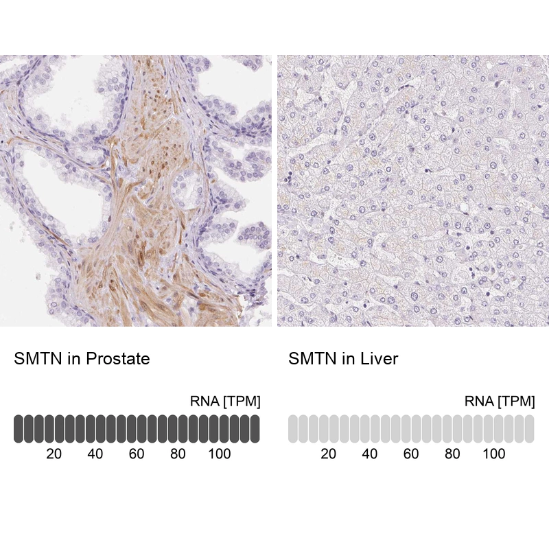 Rabbit Polyclonal Anti-SMTN Antibody - Buy for research - Highly ...