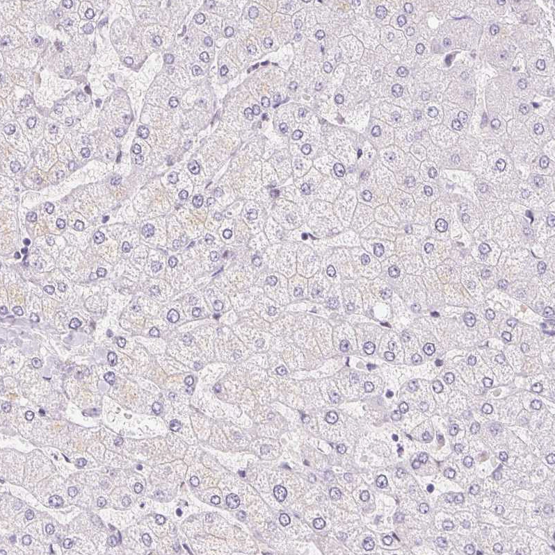 Rabbit Polyclonal Anti-SMTN Antibody - Buy for research - Highly ...