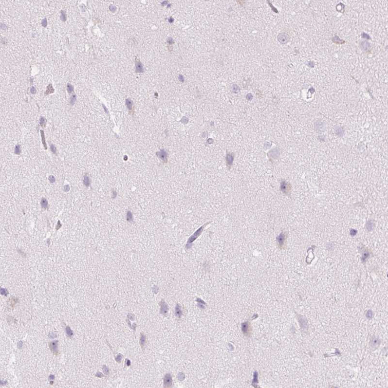 Rabbit Polyclonal Anti-CMA1 Antibody - Buy for research - Highly ...