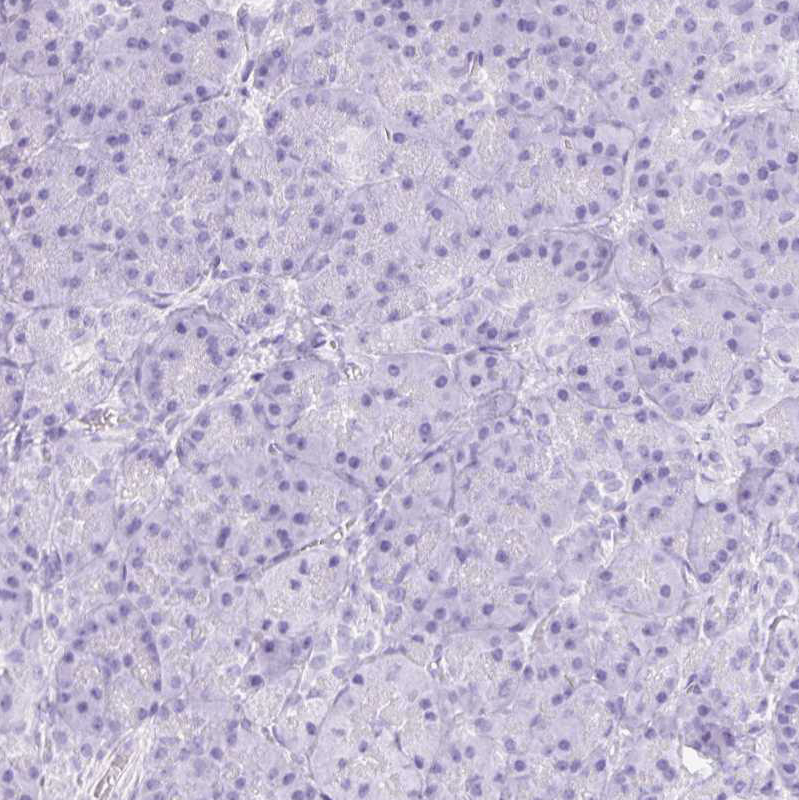 Rabbit Polyclonal Anti-CYP21A2 Antibody - Buy for research - Highly ...