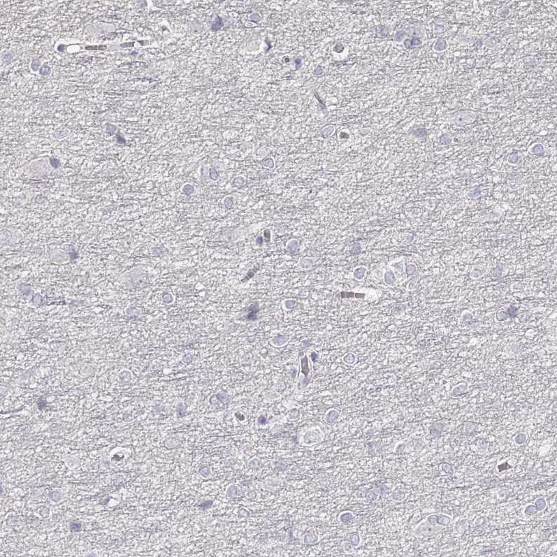 Rabbit Polyclonal Anti-ZP3 Antibody - Buy for research - Highly ...