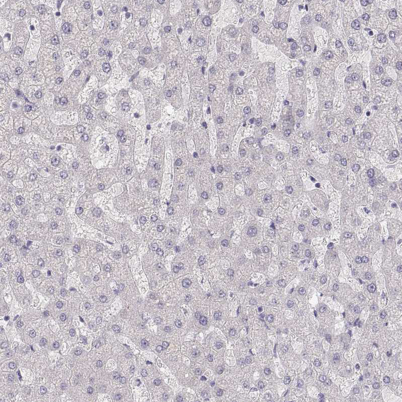 Rabbit Polyclonal Anti-ZP3 Antibody - Buy for research - Highly ...