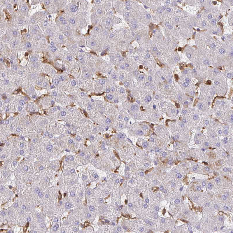 Rabbit Polyclonal Anti-PYCARD Antibody - Buy for research - Highly ...
