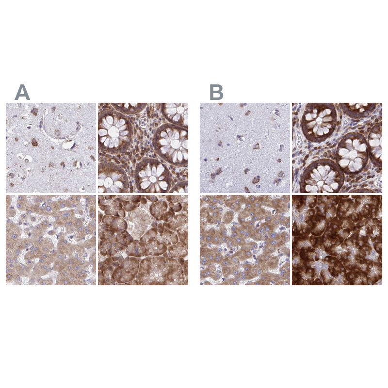 Rabbit Polyclonal Anti-RPS15 Antibody - Buy for research - Highly ...